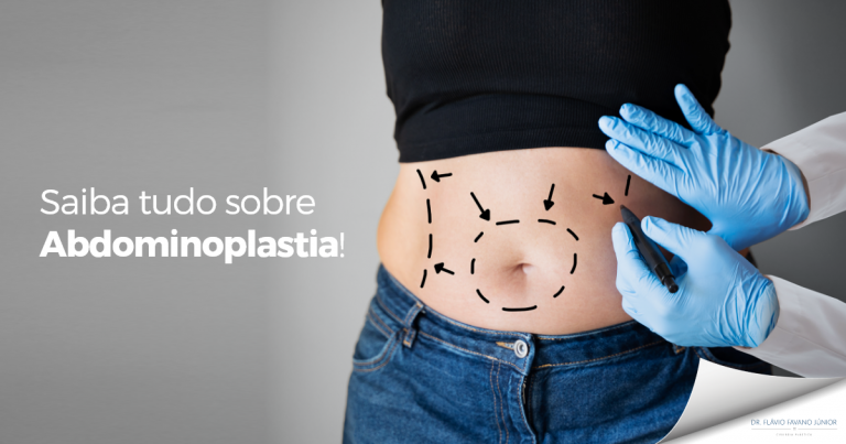 Abdominoplastia: tudo sobre a cirurgia que modela o abdômen!